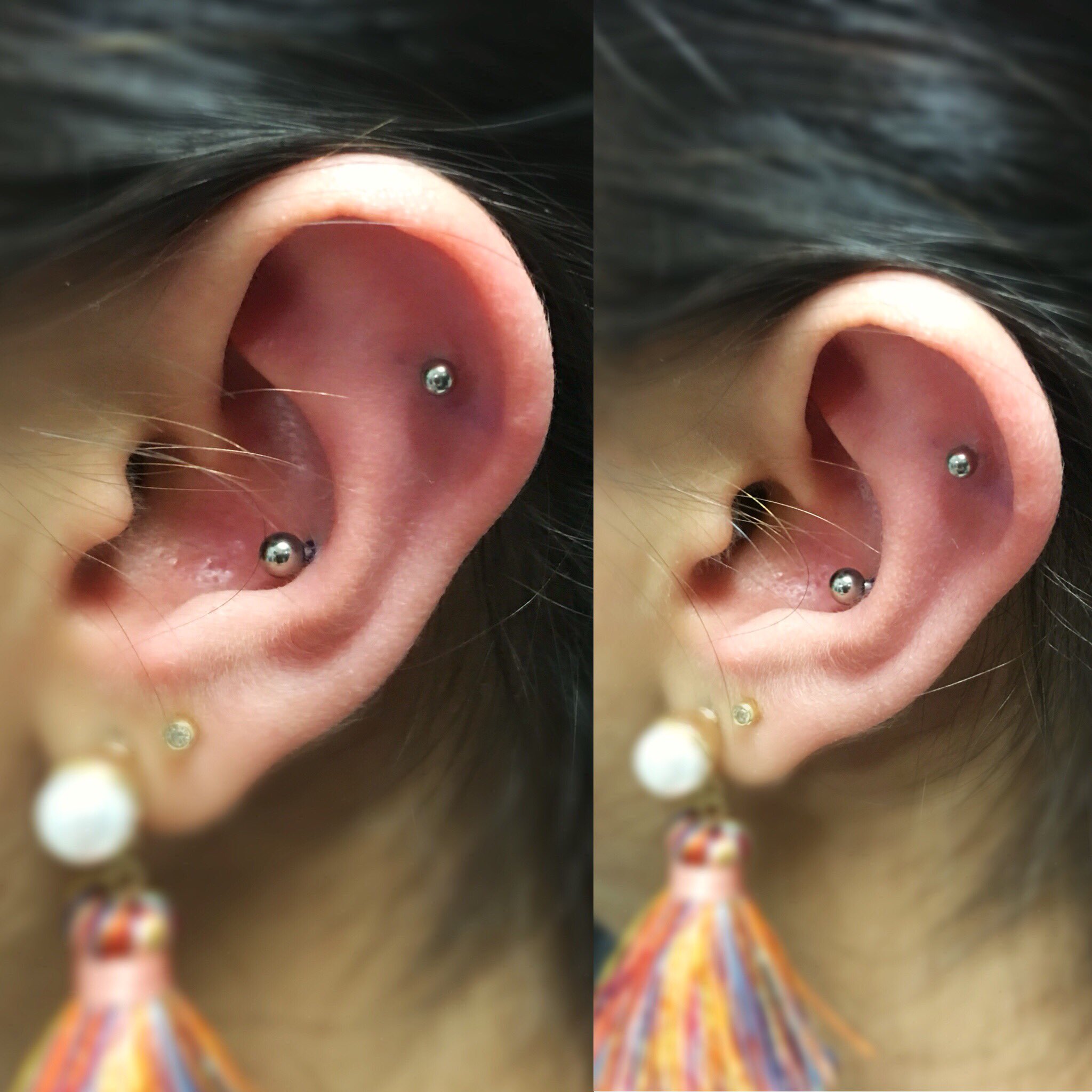 Inner And Outer Conch Piercing