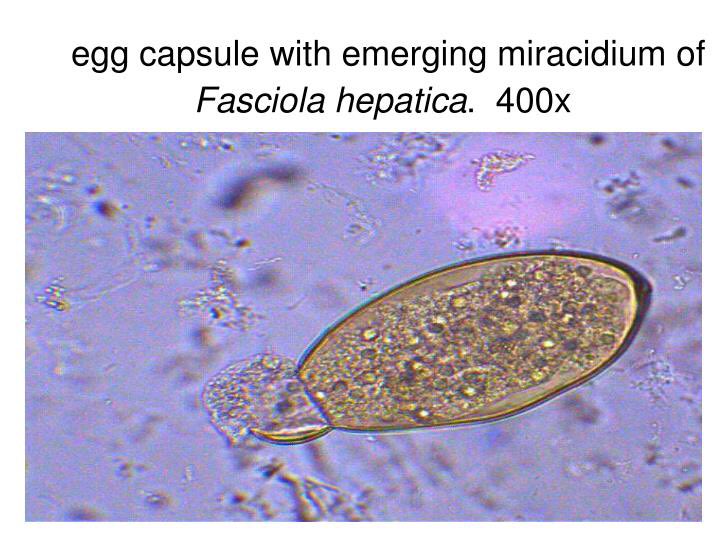 Fasciola Hepatica Miracidia