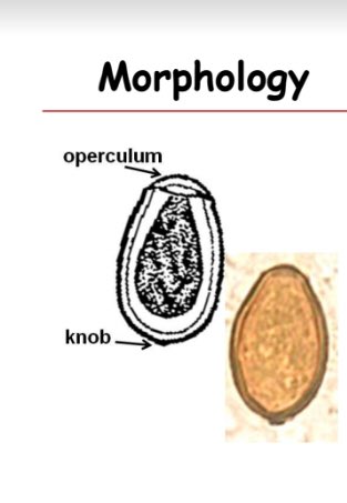 ملخص Parasitology - Twitter thread from غيداء طلال بصفر🇸🇦 @ghayda ...