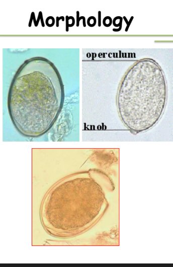 ملخص Parasitology - Twitter thread from غيداء طلال بصفر🇸🇦 @ghayda ...