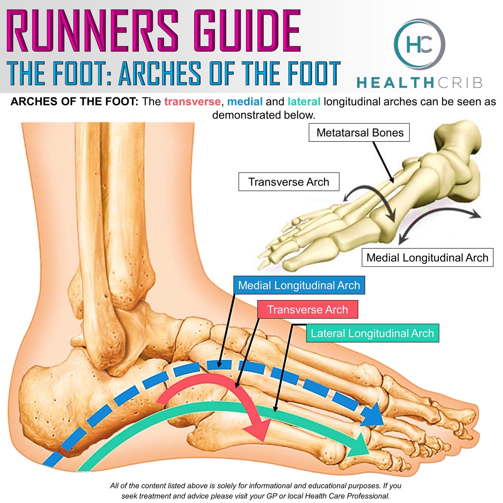 Medial Longitudinal Arch Support