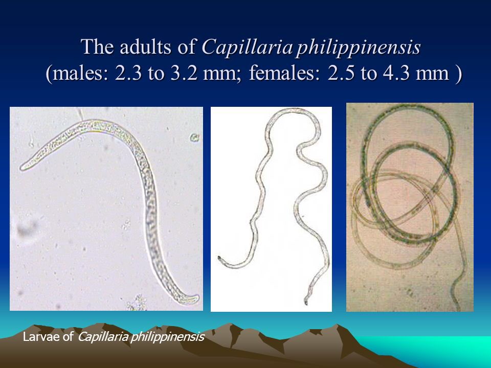 Capillaria Philippinensis Larvae