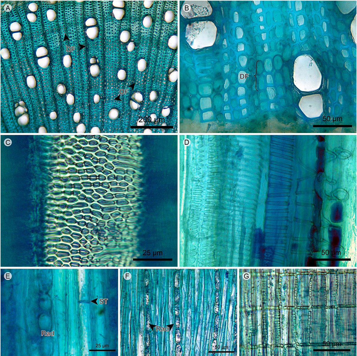 Xylem Under Microscope