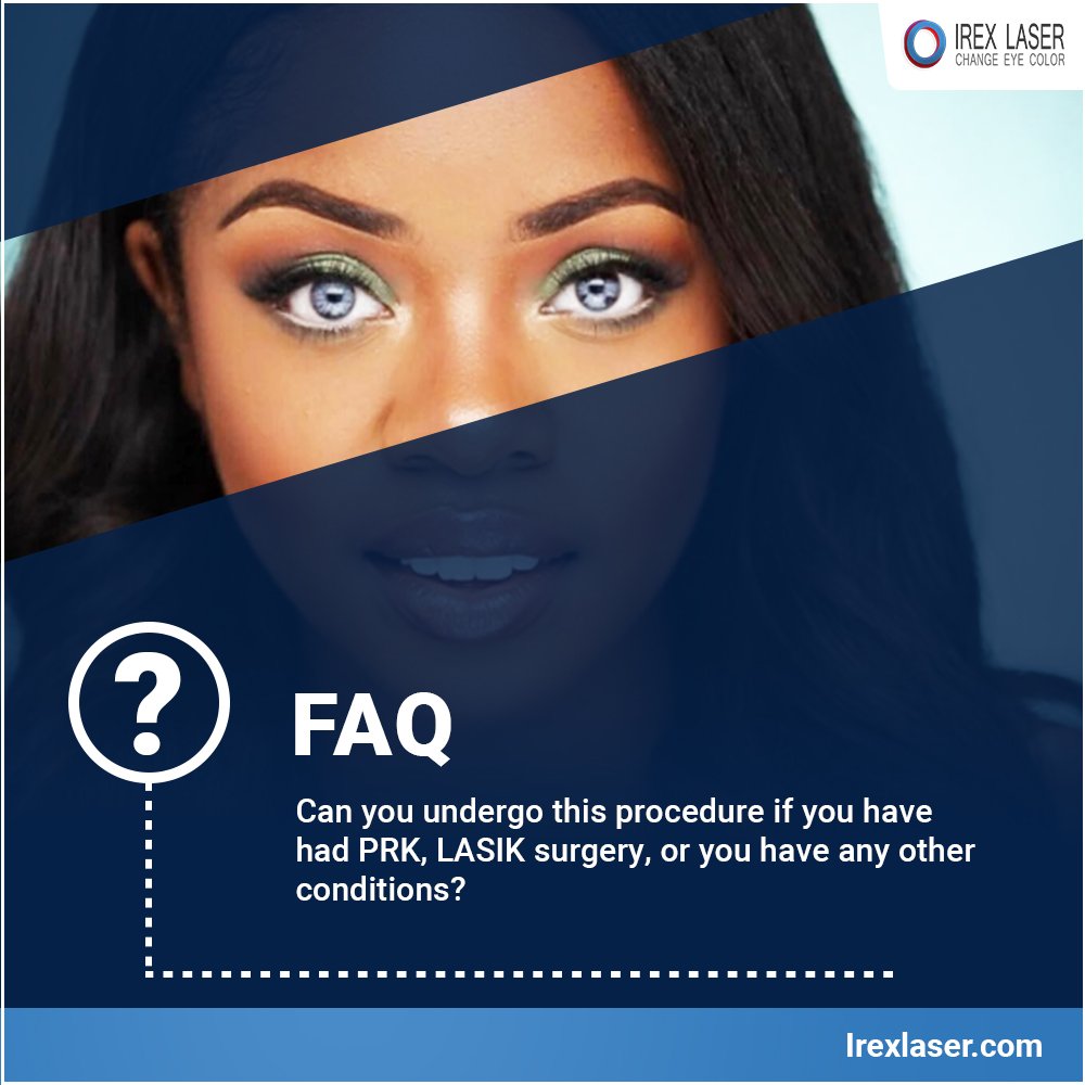 Fille récompense crochet irex laser reviews Contraintes international ...