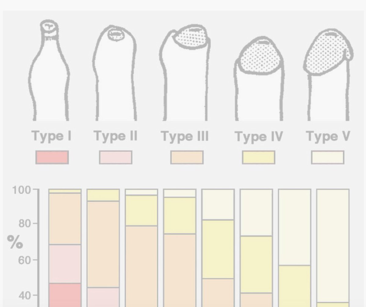 Types Of Circumcision Cuts