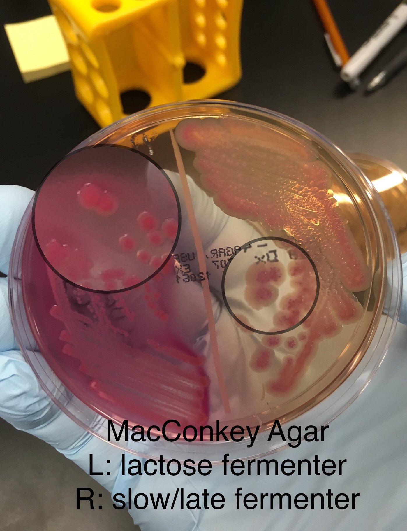 Macconkey Agar Lactose Fermentation