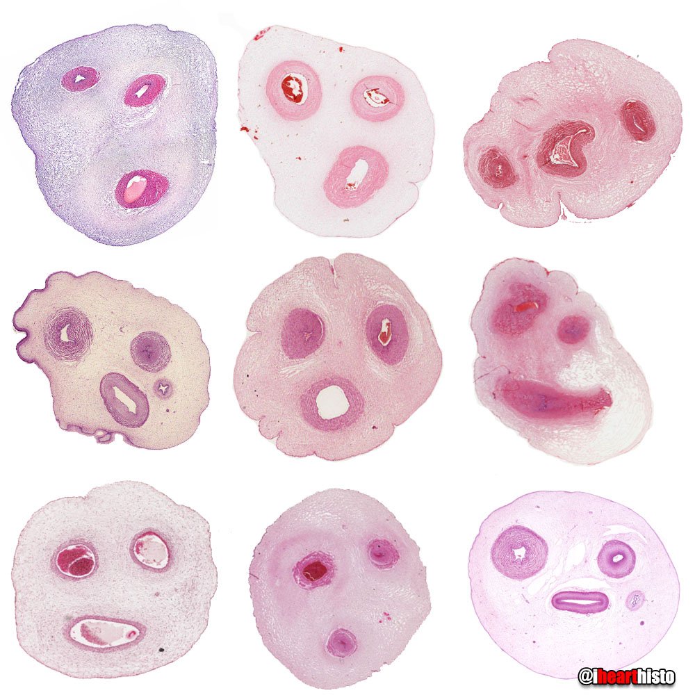 Umbilical Cord Cross Section