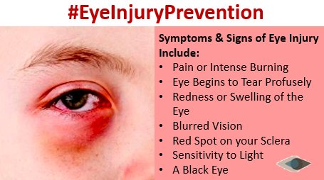 Eye Injury Prevention