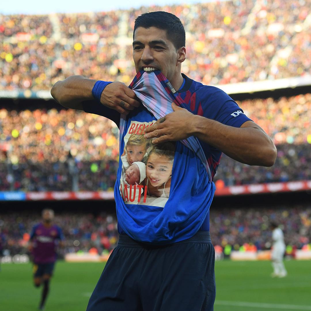 Luis Suarez Buck Teeth