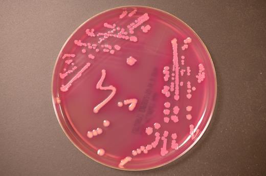 ما نوع البكتيريا؟ 🤔🤔 الطبق MacConkey agar Lactose + Motility + Citrate ...