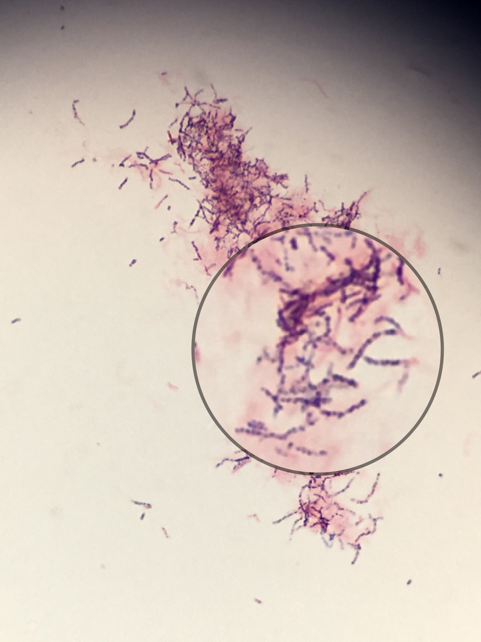 Gram Positive Rods Microscope