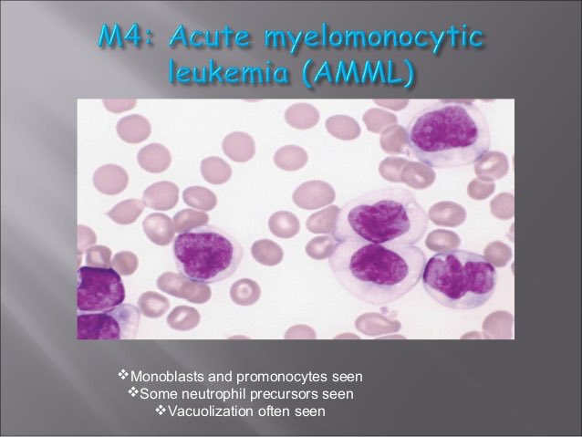 @MLS_2015 @iLabClub @MedicalLabs12 @LabSpecialist @lab_space_17 ...