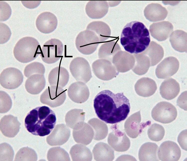 @MLS_2015 @iLabClub @MedicalLabs12 @LabSpecialist @lab_space_17 ...