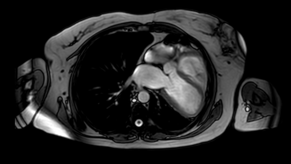 the eyes can't see what the mind doesn't know - Thread from kazi ...