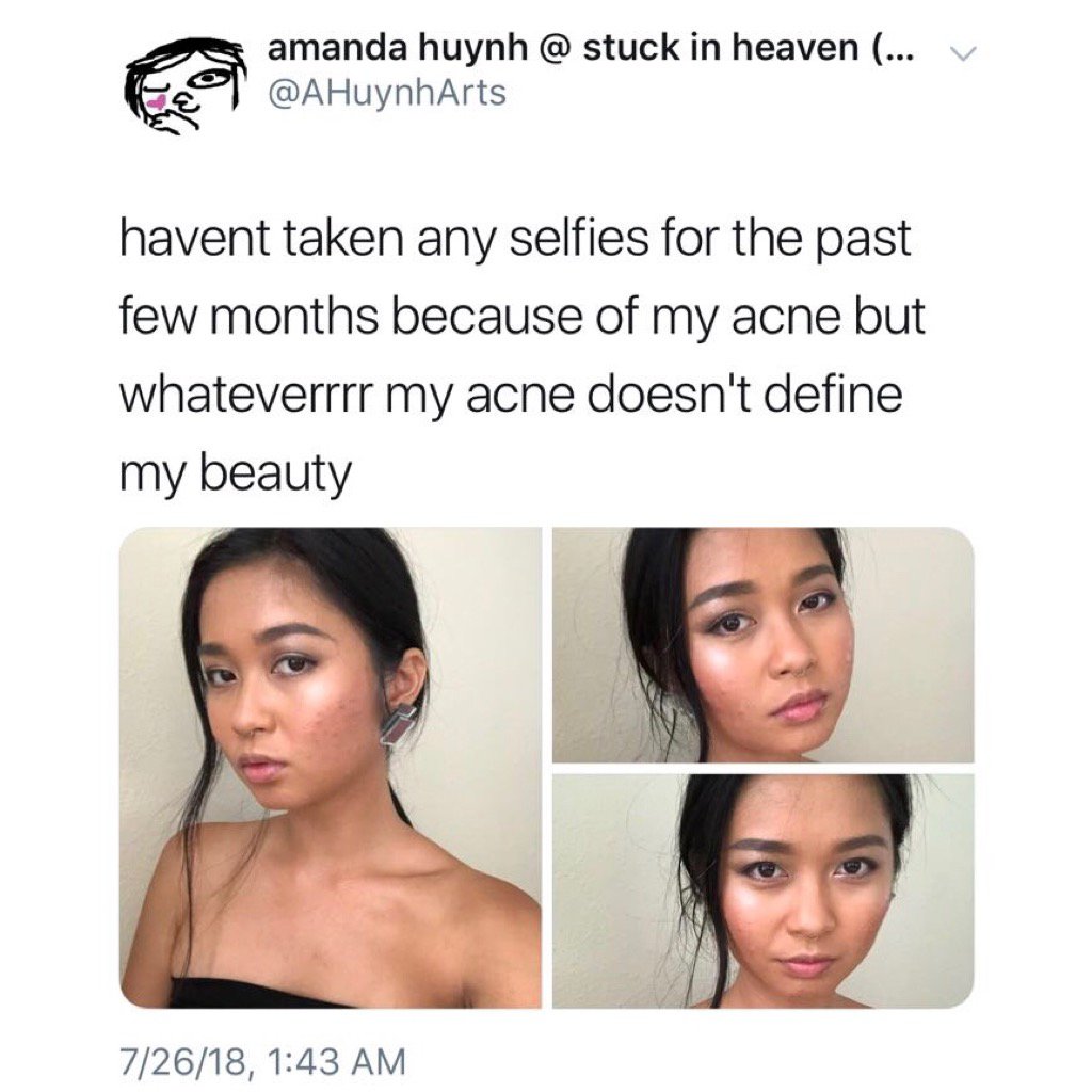 Acne Covered With Makeup Meme | Makeupview.co