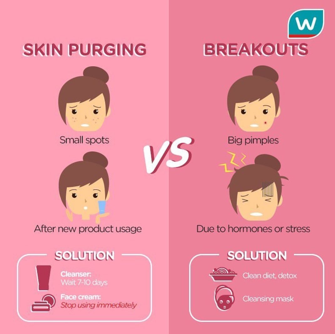Skin Purging Breakout How To Tell The Difference Paulas 56 Off