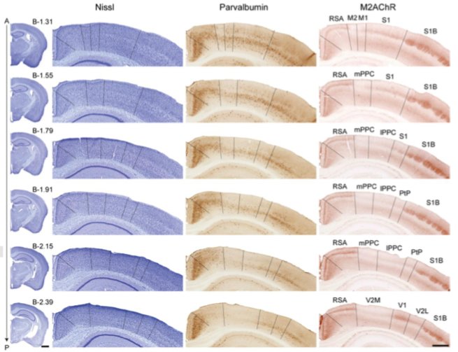 Parietal Cortex Mouse
