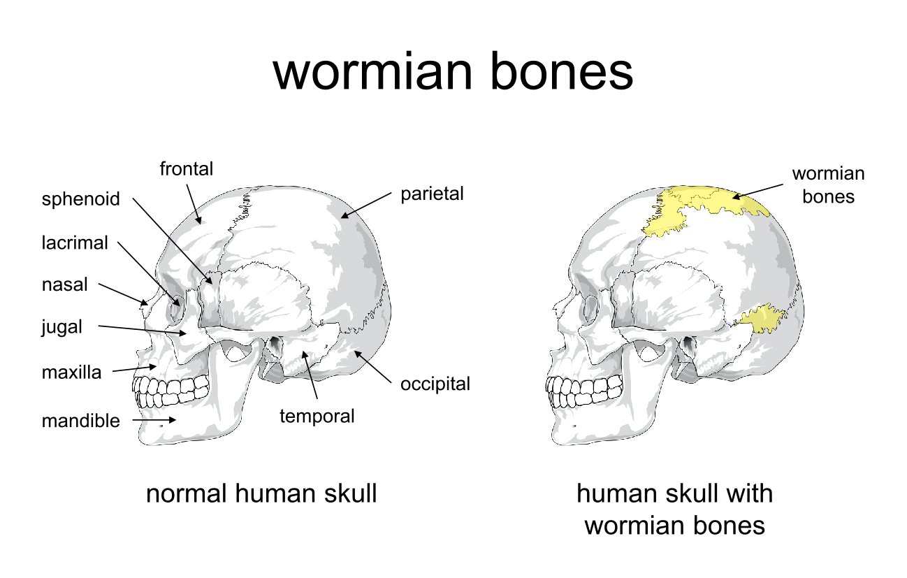Sutural Bone