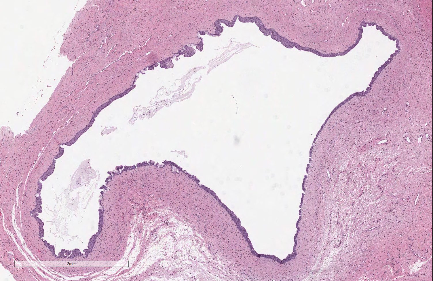 Bartholin Gland Histology