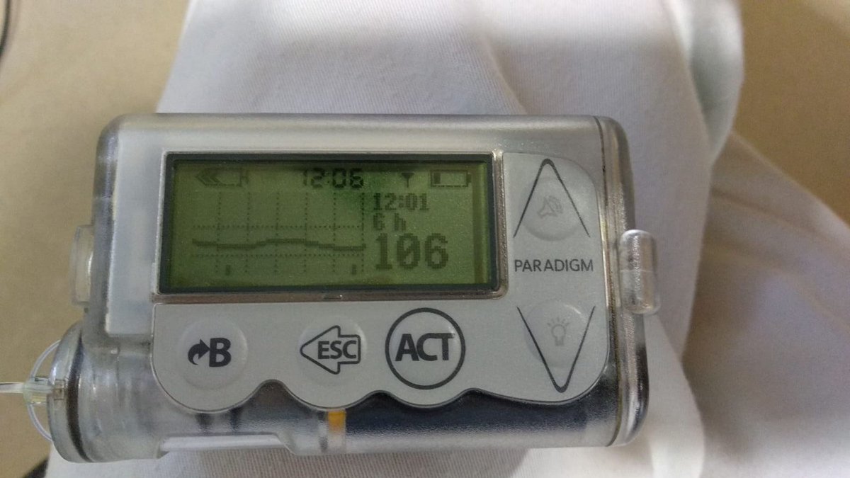 OpenAPS.org (@OpenAPS) | Twitter