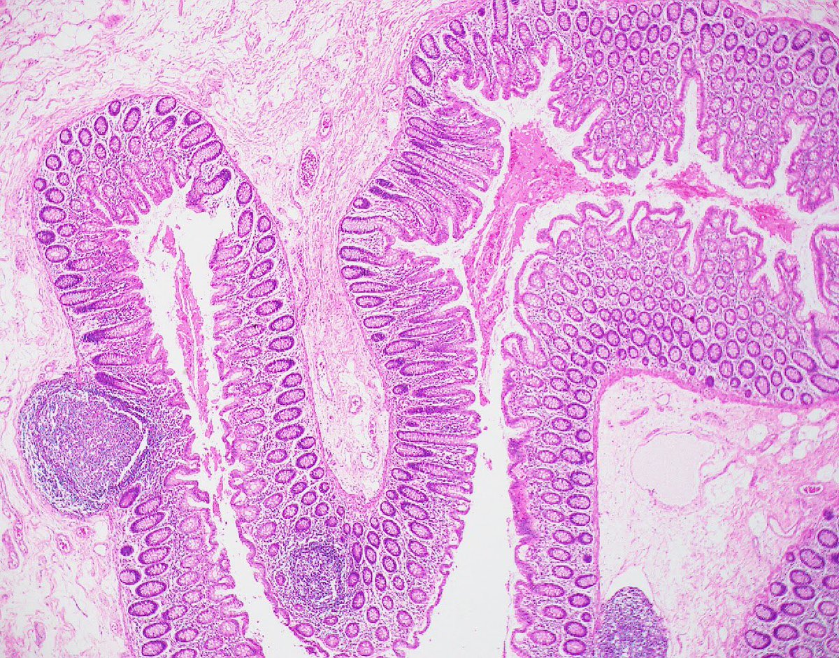 Colon Histology