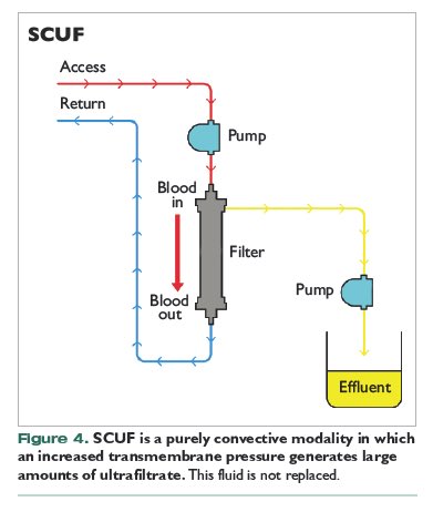 تعرفون الـ CRRT : Continuous renal replacement therapy غسيل الكلى بحالة ...