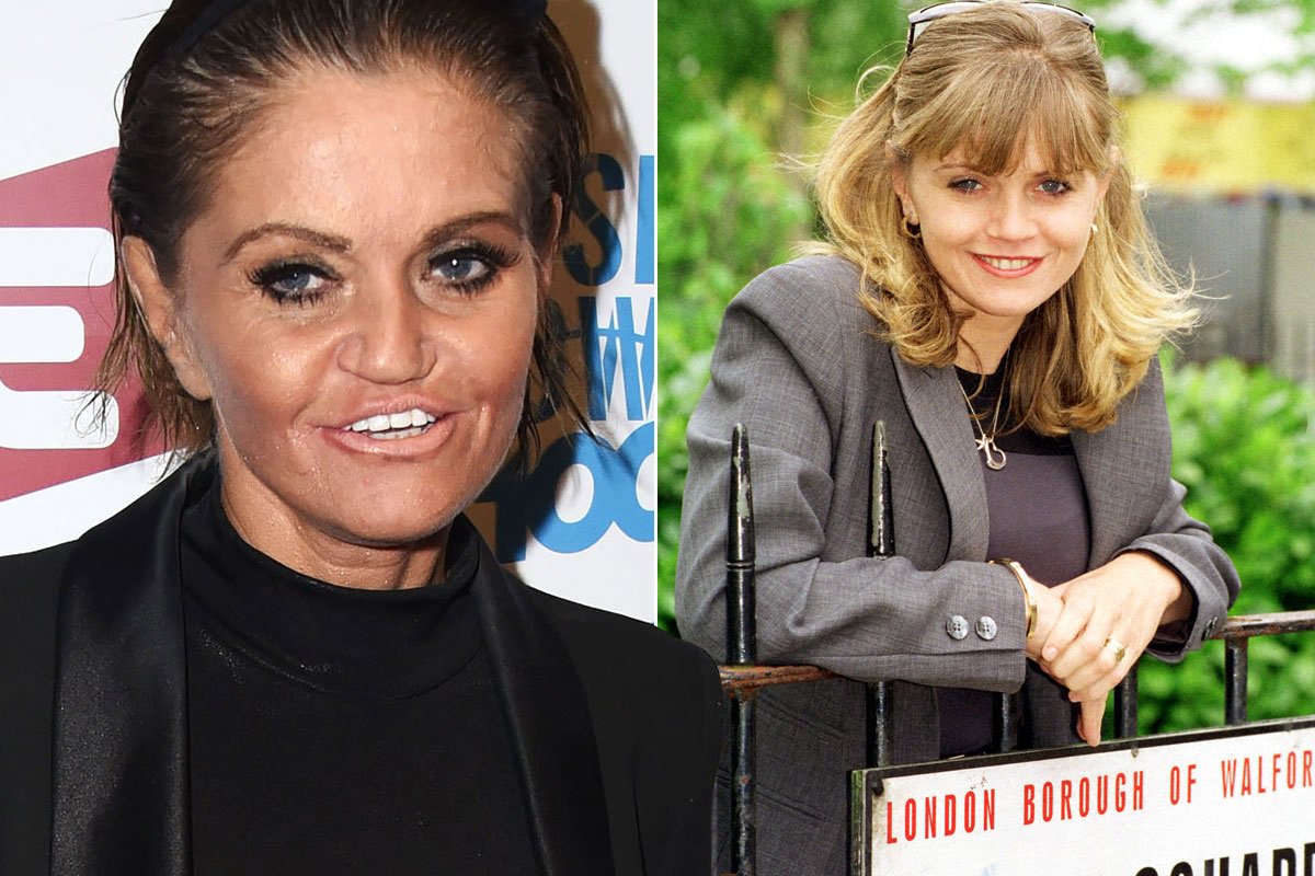 Celebrity Drug Addict Before And After
