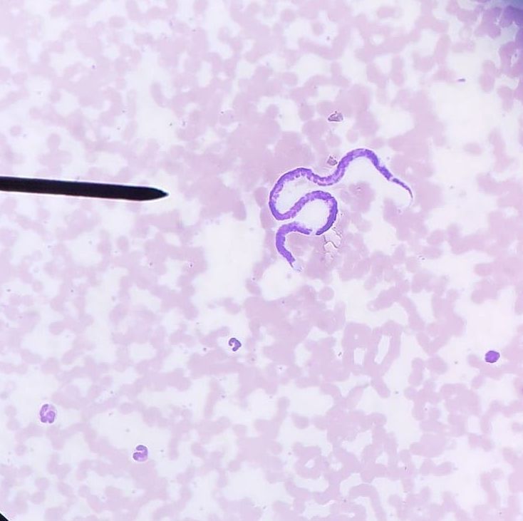 Heart Worm Blood Smear