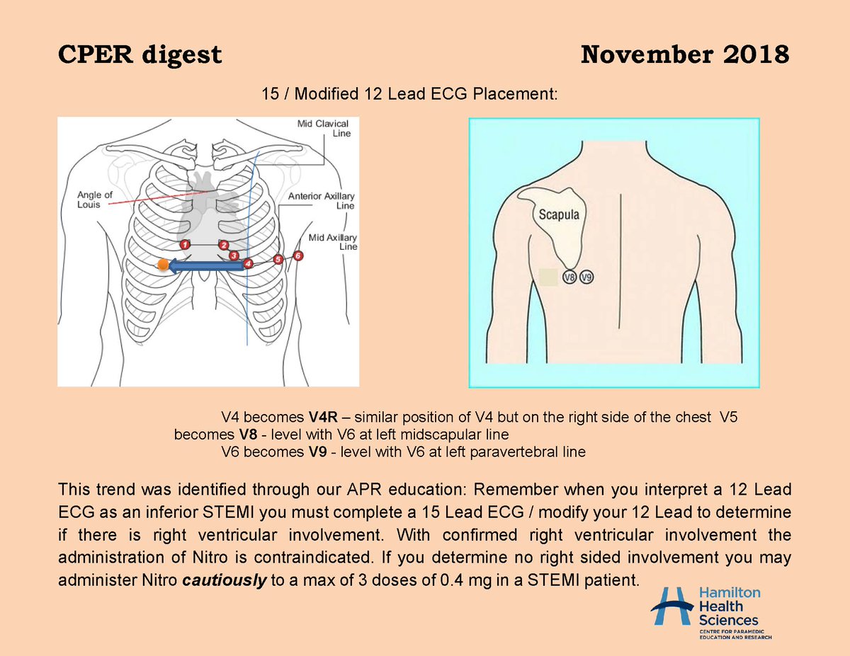 Midscapular Line