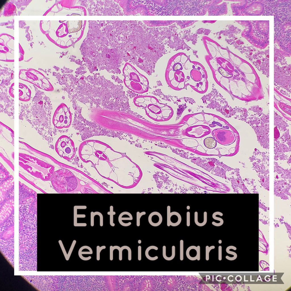 Enterobius Vermicularis Labeled