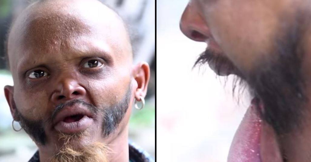 The Smallest Head In The World