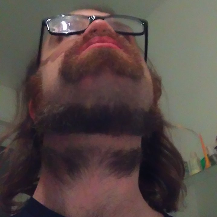 a new species of neck beard : r/Justfuckmyshitup