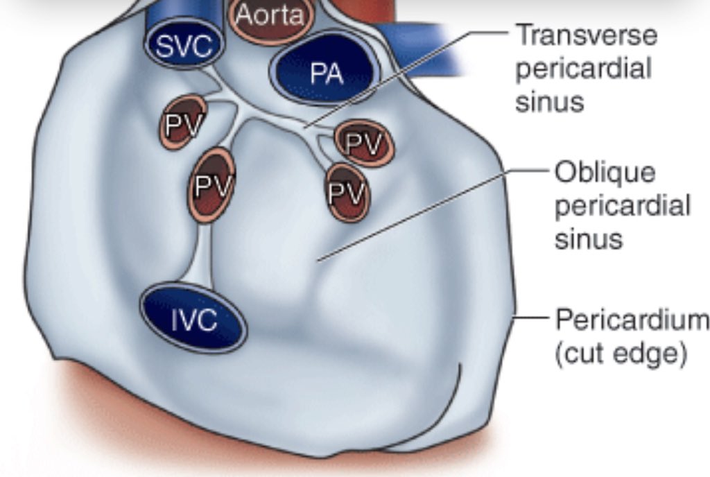 Transverse Pericardial Sinus