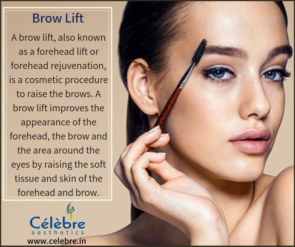 Big Forehead Unattractive