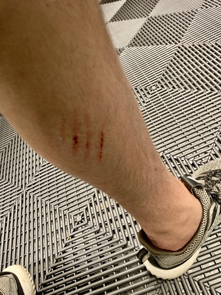 Bear Trap Injury