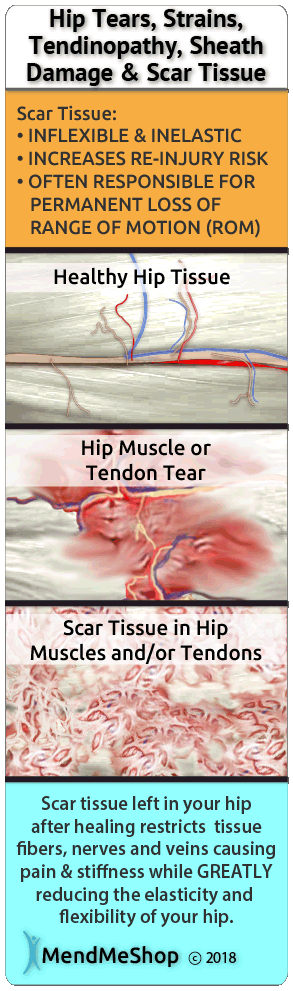 Muscle Scar Tissue