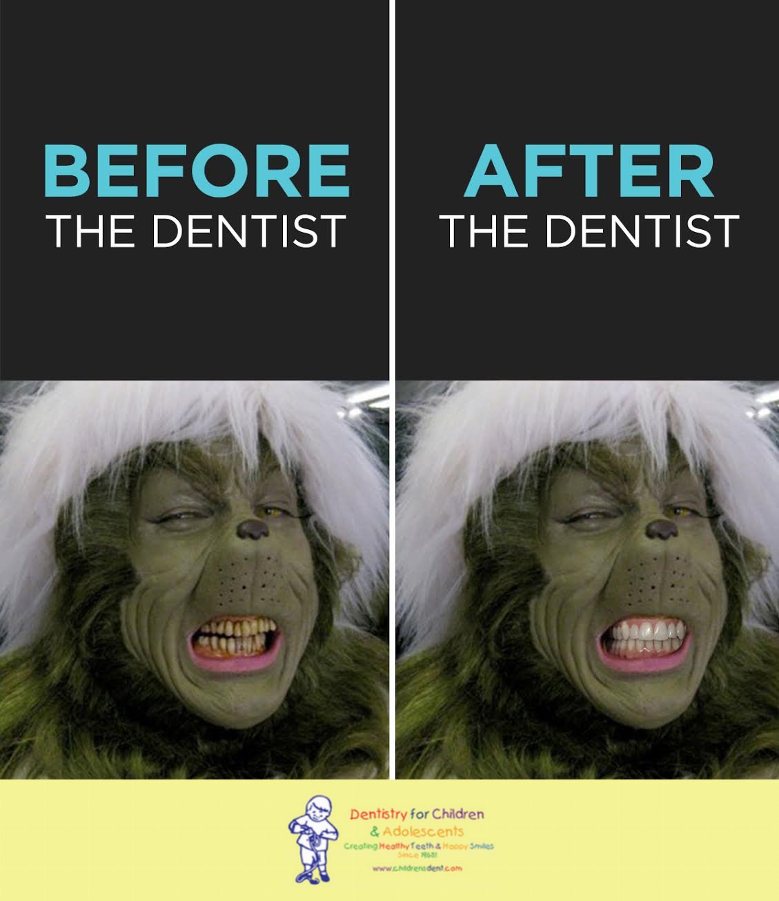 Grinch Teeth
