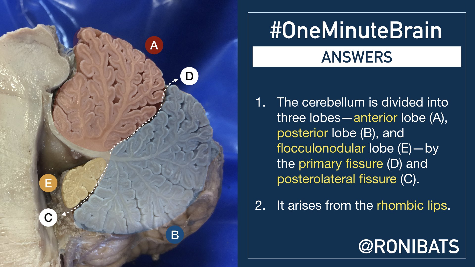 Flocculonodular Lobe