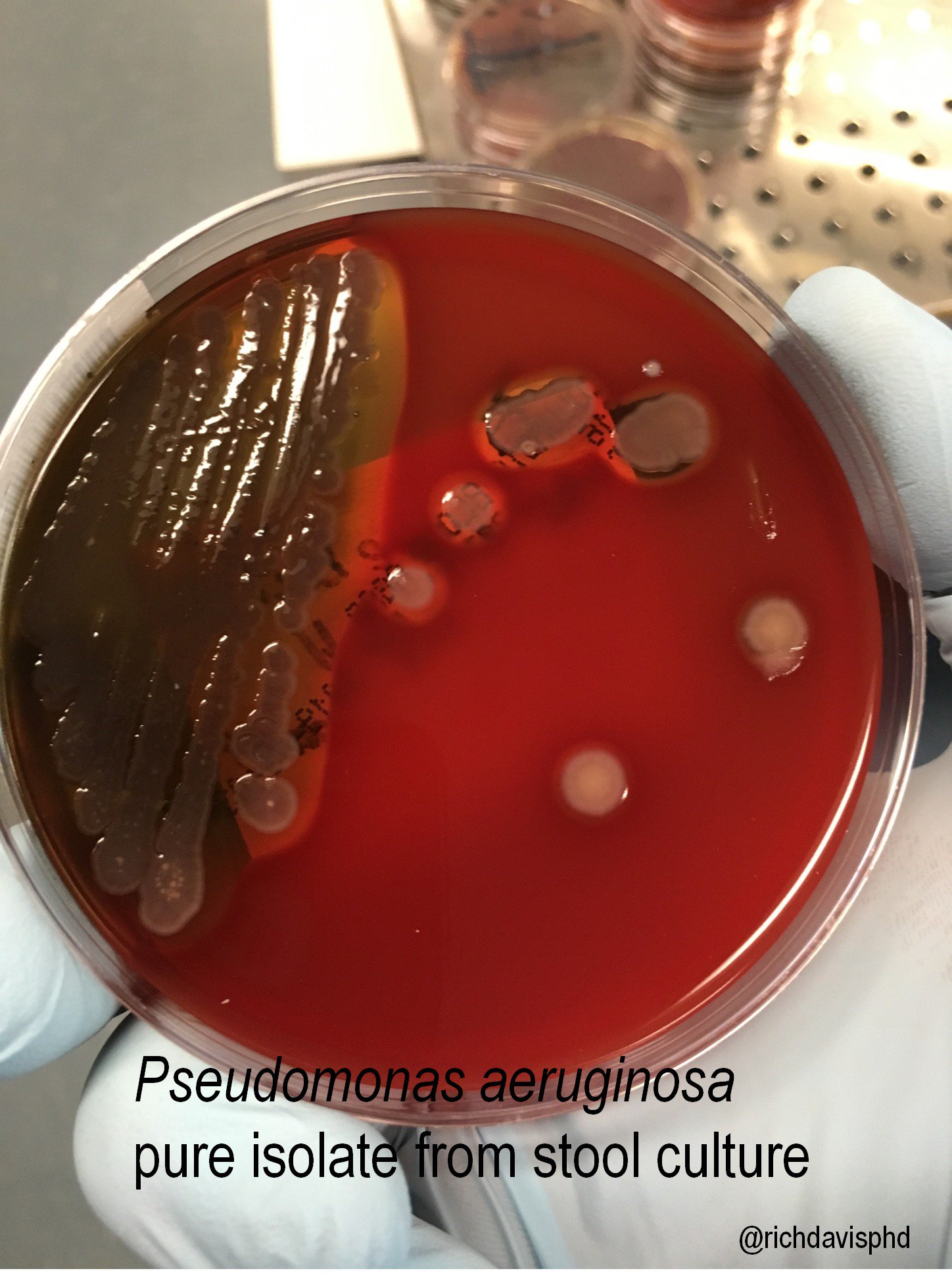 Pseudomonas Aeruginosa Culture