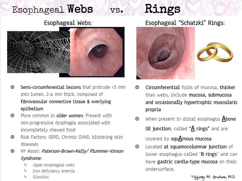 Esophageal Webs And Rings