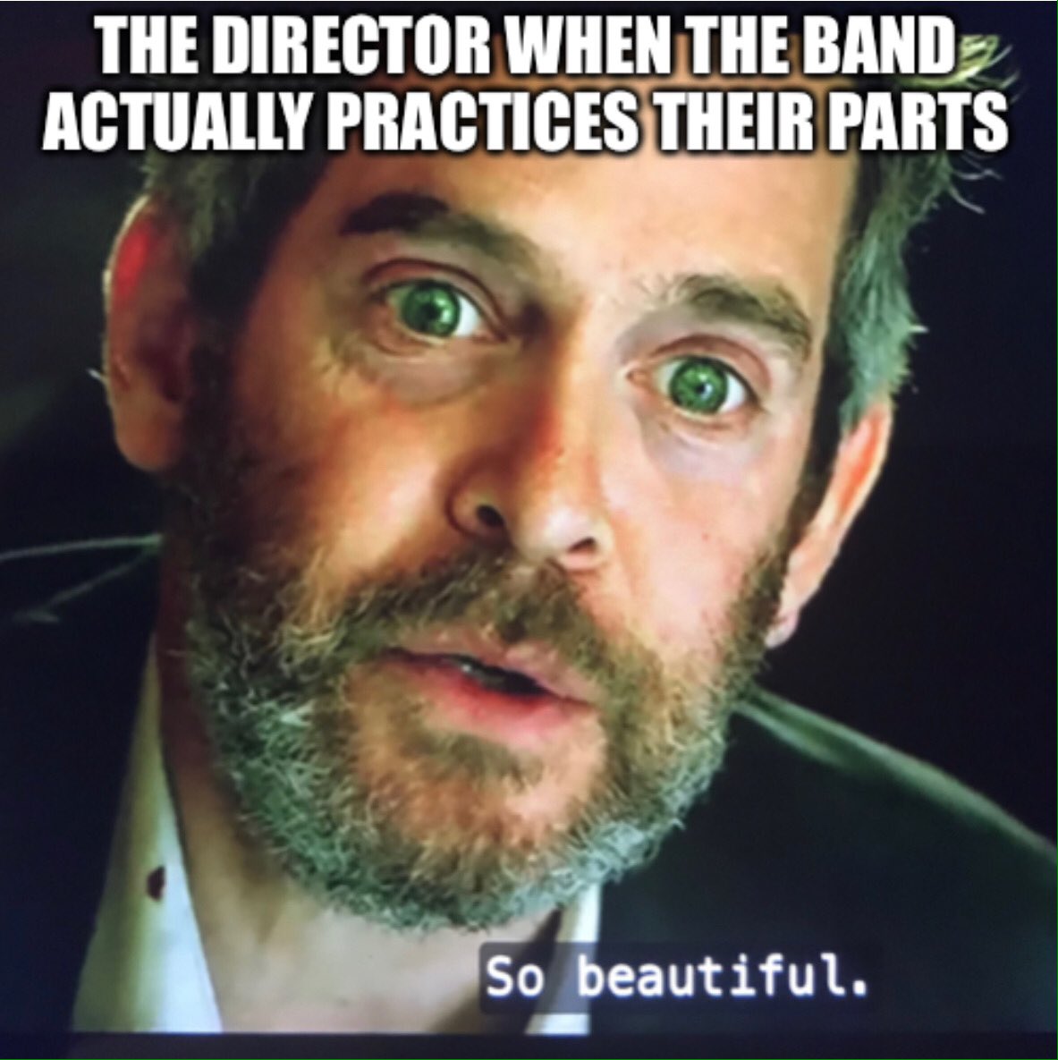 Dr House Lupus Meme