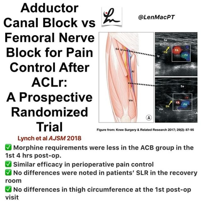 Fnb Verse Adductor Canal Block