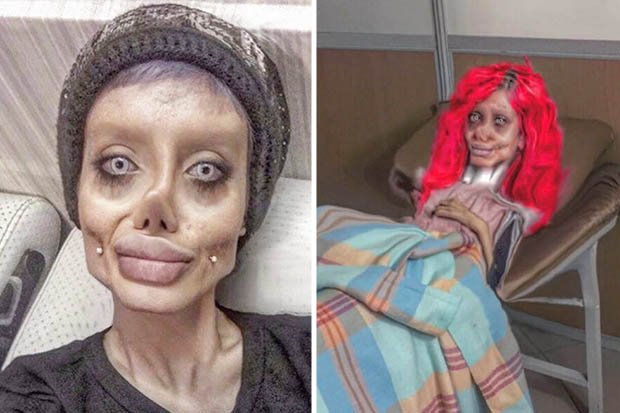 Angelina Jolie ‘lookalike’ Sahar Tabar claims she’s ‘broken her neck ...