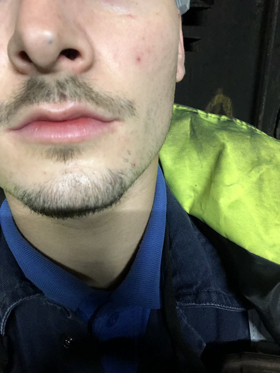 You're Not Alone If You Still See the Stab Mark from the Pencil in School