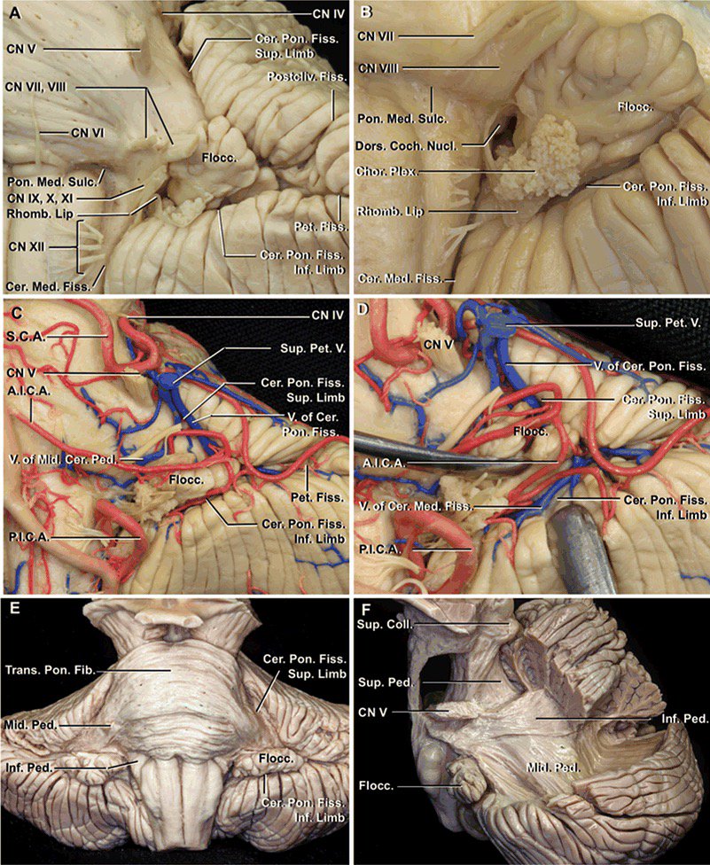Brainstem Anatomy Netter