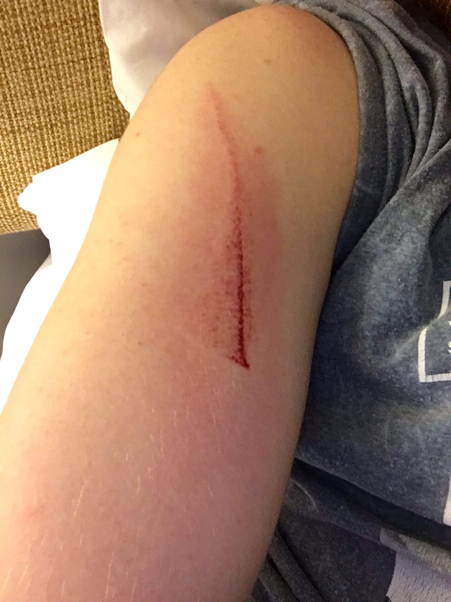 Knife Cuts On Arm