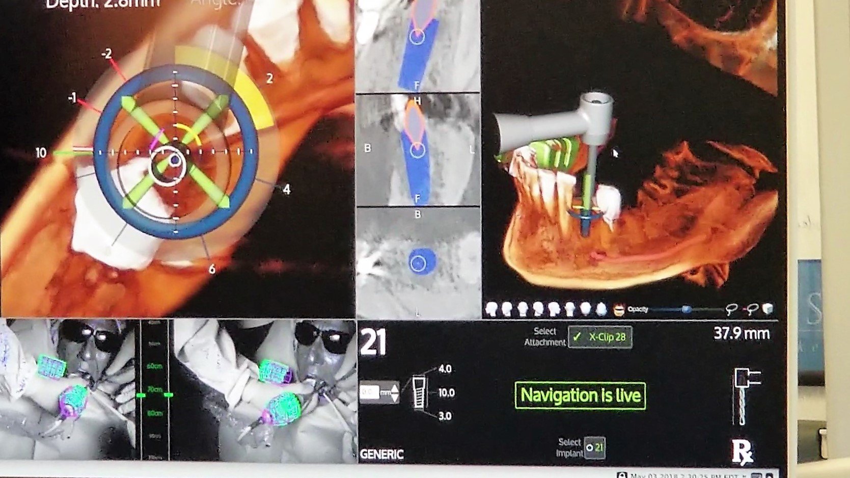 Facial Imaging Mobile on Twitter: "Join Leslie-Ann Furie, DDS and Andrew Samuel, DMD on Jan ...