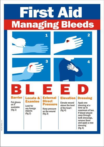 External Bleeding Treatment
