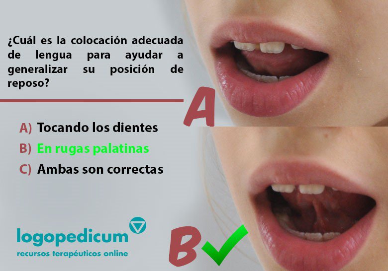 Posicion De La Lengua En Reposo - geographicstory Posicion De La Lengua En Reposo - geographicstory
