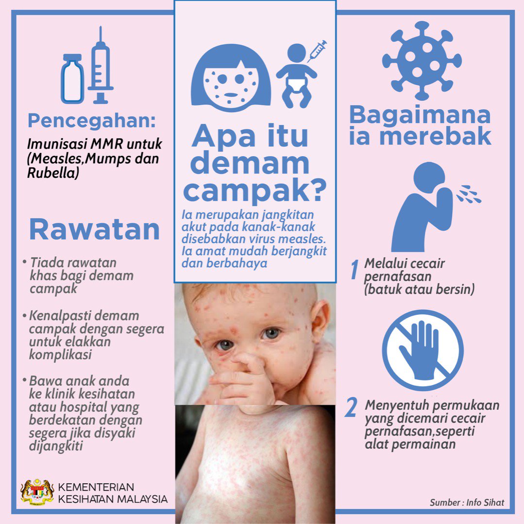 Apa Itu Cacar Air Definisi Dan Maknanya Kesihatan My Xxx Hot Girl